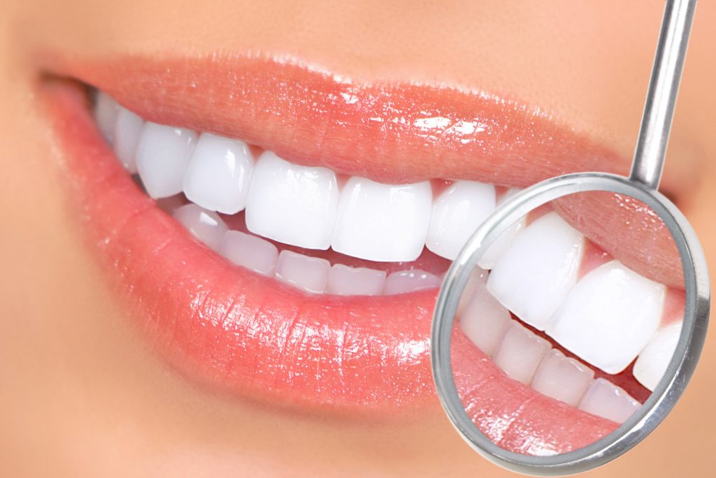 Aplicación De Flúor En Metepec - City Dental